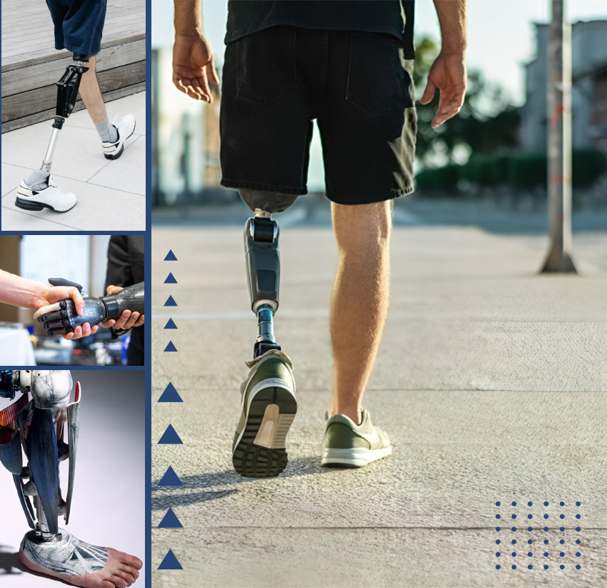 Ana Sayfa - Proted Prosthetics & Orthotics